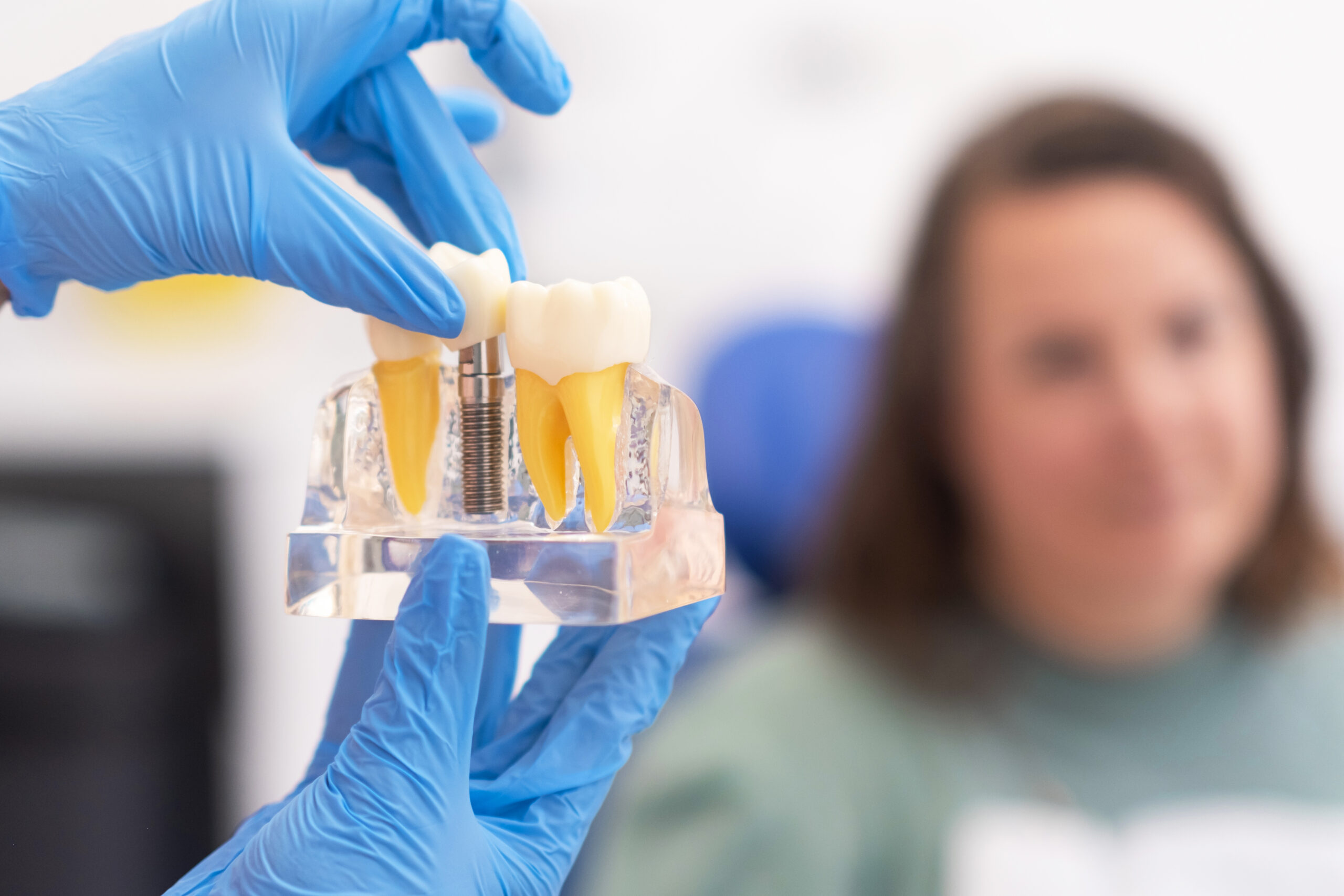 Restore Your Brightest Smile with Dental Implants Tucson